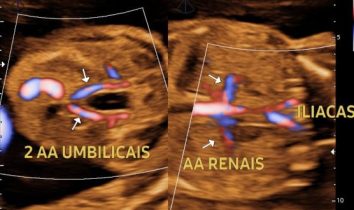 Morfológico do 2º Trimestre - Clínica de Ultrassom Dra. Morgana Kummer