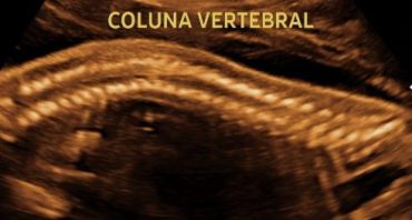 Morfológico do 2º Trimestre - Clínica de Ultrassom Dra. Morgana Kummer